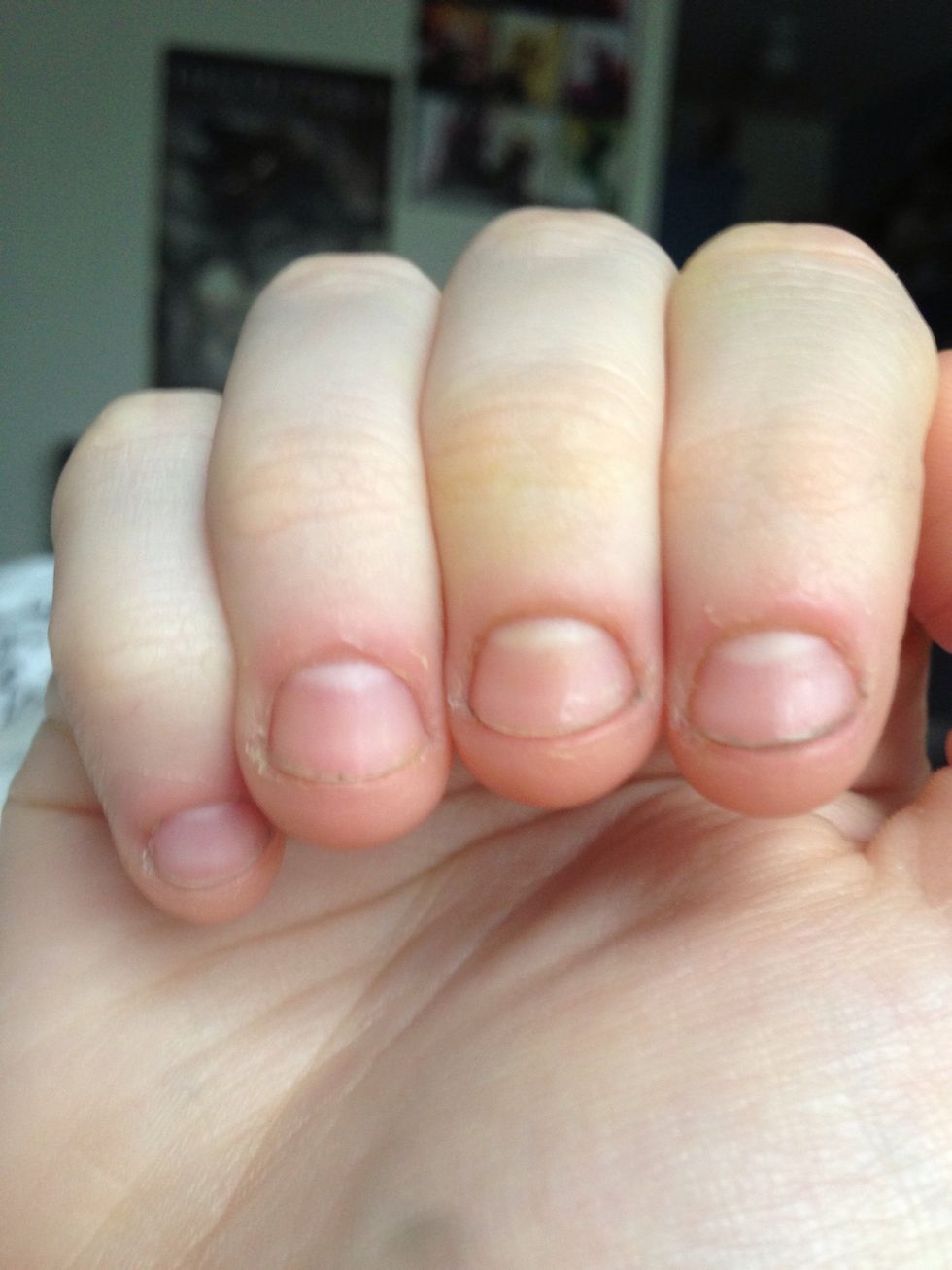 How to fix and grow out bitten nails - B+C Guides
