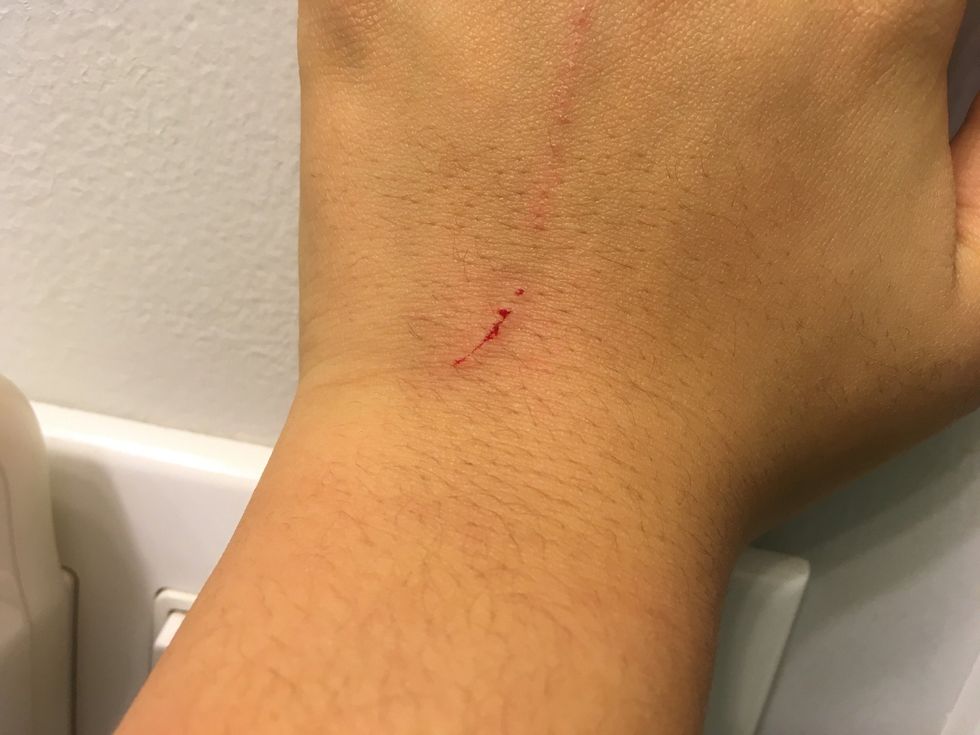 How to care for a minor cut - B+C Guides