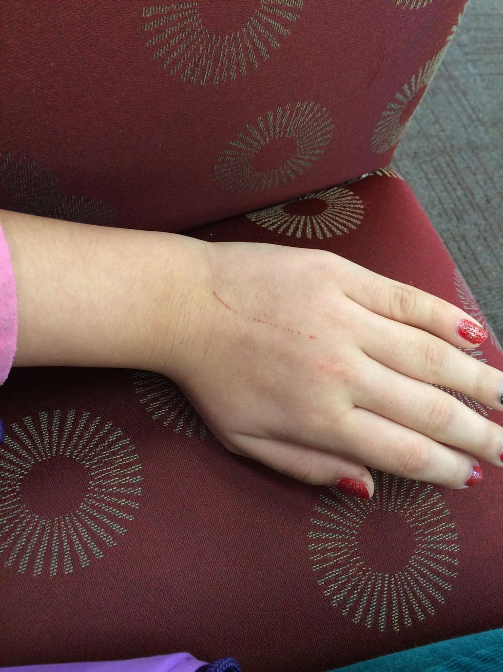 How to care for a minor cut - B+C Guides